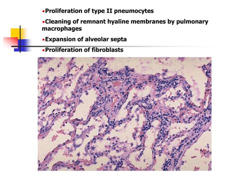 Ppt The Pathology Of Lung Diseases Powerpoint Presentation Free