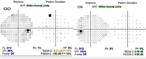 Humphrey Visual Field Plot Post Treatment On Th Day Of Download Scientific Diagram