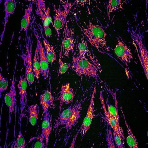 Dr Isabelle Buckle On Linkedin Mitochondrial Biology Research