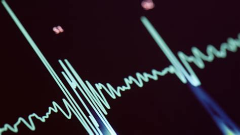 Atrial Flutter Vs Atrial Fibrillation Afib Whats The Difference