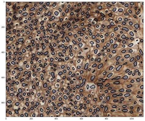 Hsv Color Model Segmentation And Classification… By Javier Abellán Abenza Neurosapiens Medium