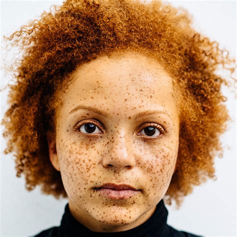Stunning Pics Show Beauty Of Redheads Of Colour People With Red Hair
