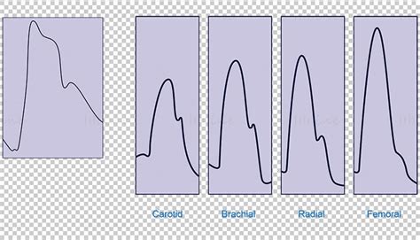 The Normal Arterial Pulse Vector Illustration