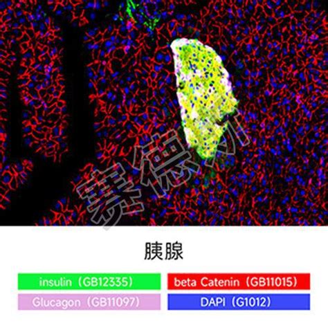 免疫荧光三标四色扫描分析全套（切片） 合肥赛德斯生物科技有限公司