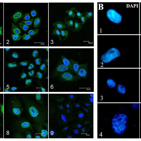 Localization Of Mta1 On Microtubules In The Cytoplasm Nci H446 Cells
