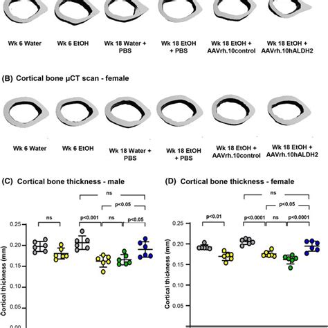 Three‐dimensional μct Reconstructions Of Femoral Cortical Bone For Download Scientific Diagram