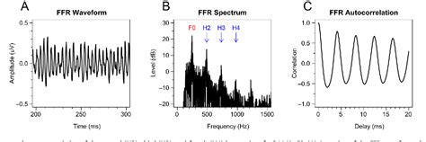 Figure 4 From Pitch Coding And Pitch Processing In The Human Brain