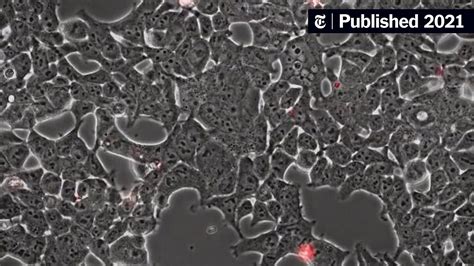 A Microscopic Video Shows The Coronavirus On The Rampage The New