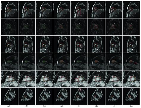 Detection Examples By Proposed Methods And Compared Detection Methods Download Scientific