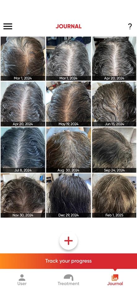 Revian Red Hair Growth System The Right Light For Hair Growth