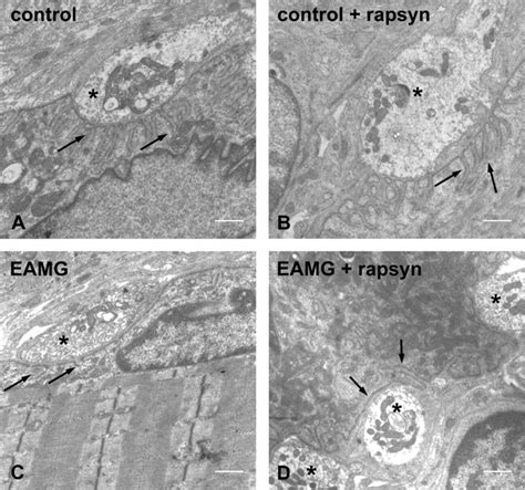 Overexpression Of Rapsyn In Rat Muscle Increases Acetylcholine Receptor