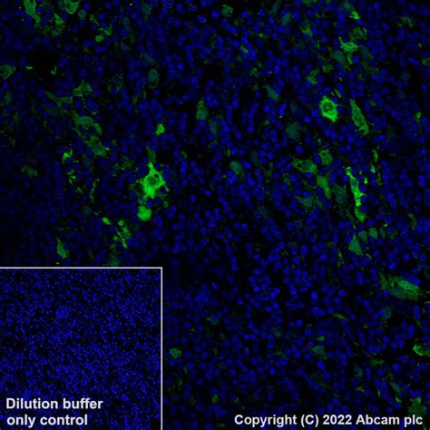 Alexa Fluor® 488 Anti Mertk Antibody Y323 Ab307385 Abcam