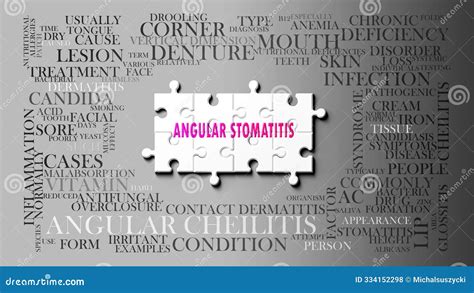 Angular Stomatitis As A Complex Subject Related To Important Topics Spreading Around As A Word