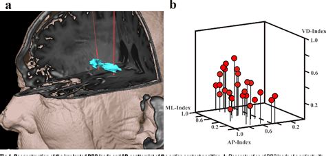 figure 3 from using mdeft mri sequences to target the gpi in dbs