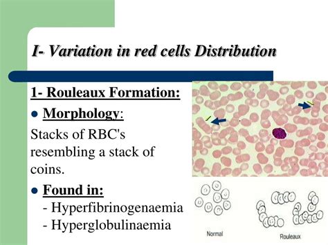 Ppt Rbcs Abnormal Morphology Powerpoint Presentation Free Download Id 591555