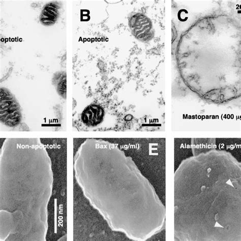 Apoptotic Mitochondria Exhibit Normal Size And Morphology On Electron