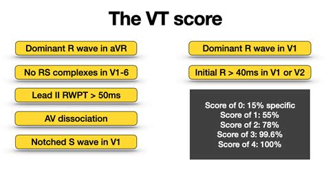 Vt Versus Svt Its As Easy As Abcde • Litfl • Ecg Library