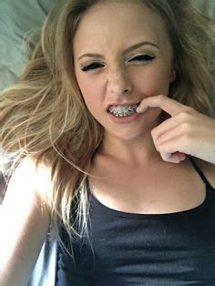 10 Braces Ideas Braces Girls Cute Braces Braces