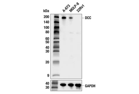 DCC E4U1X Rabbit MAb Cell Signaling Technology