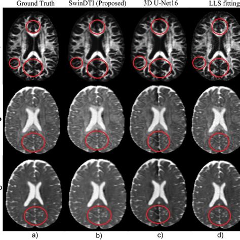 64 dwis diffusion directional signal compared with swindti proposed