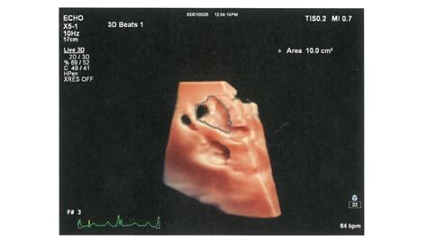 Fundraiser By Abdullahi Ahmed Help Support My Journey Toward Better