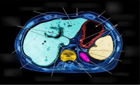 Hida Scan Diagram Quizlet