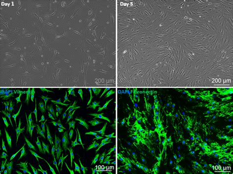 Human Fibroblast Like Synoviocytes Hfls Ixcells