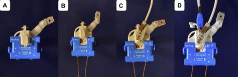 First In Human Use Of A Continuous Real Time Atrial Electrogram