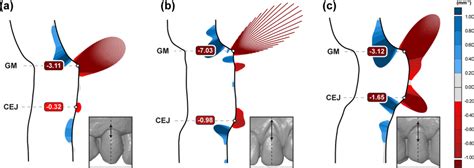 Cross Section Shapes Of Representative Gingival Margin Gm And