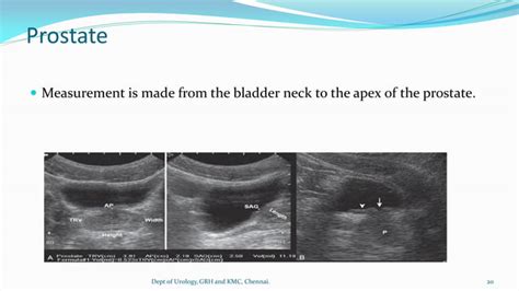 Ultrasound In Urology Pdf