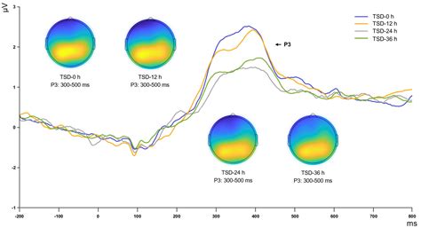 Non Linear Effects Of Acute Sleep Deprivation On Spatial Working Memory Cognitive Depletion And