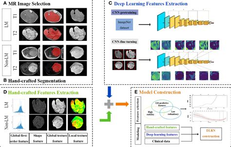 Frontiers Deep Learning Radiomics Nomogram To Predict Lung Metastasis In Soft Tissue Sarcoma