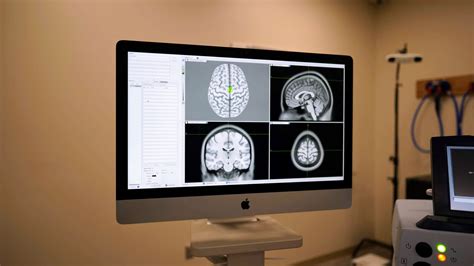 Non Invasive Neuromodulation Laboratory Research Core Mndrive Brain