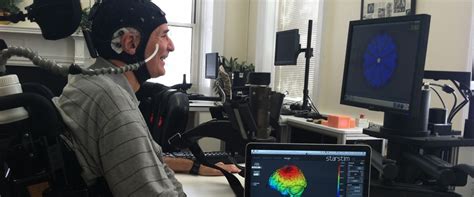 Transcranial Direct Current Stimulation Tdcs Burke Neurological Institute Weill Cornell