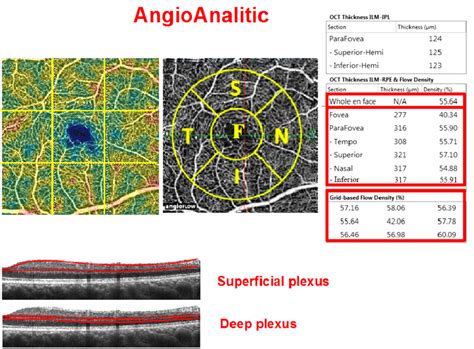 Macular Vascular Density Protocol Angiovue Retina Protocol Rtvue Xr Download Scientific