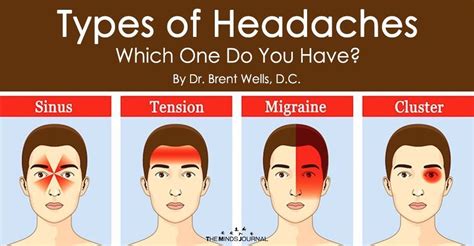 What Different Parts Of Headaches Mean At Fred Mounce Blog