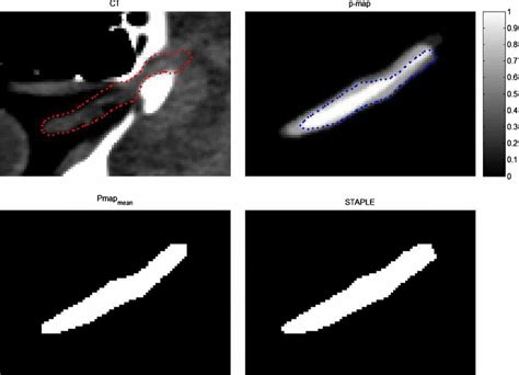 Ground Truth Estimation The Upper Left Panel Displays The Area Of An Download Scientific