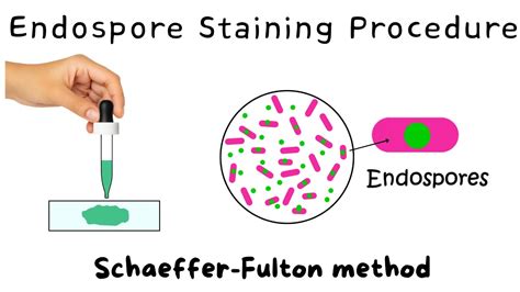 Endospore Staining Principle Procedure Result