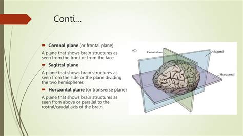 Parts Of Brain Mainly The Forebrain Pptx
