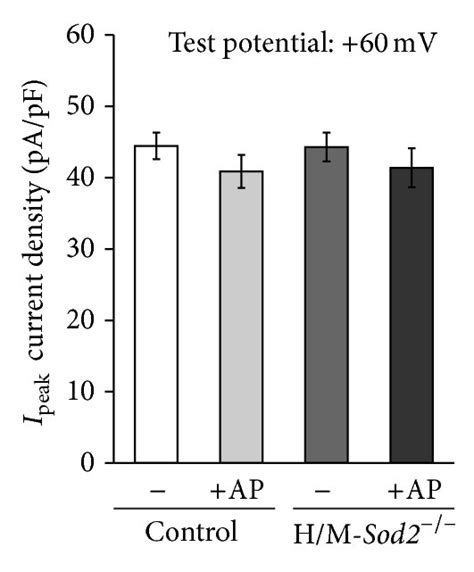 L Type Ca²⁺ And Outward K⁺ Currents Recorded From The Ventricular Cells