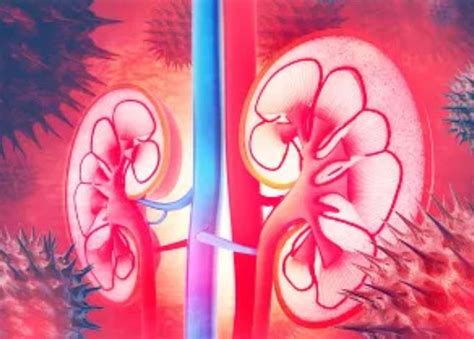 肾小球肾炎会不会最终进展成尿毒症？肾炎也分很多种类？ 12健康