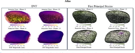 Figure 8 From High Resolution Maps Of Left Atrial Displacements And