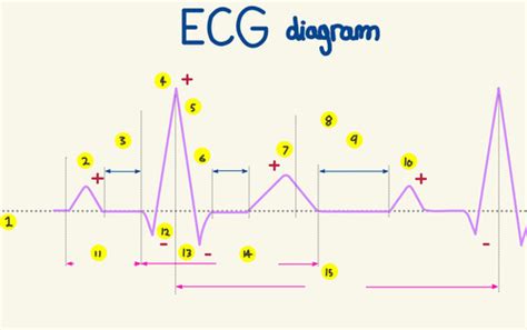 Ecg Diagram Flashcards Quizlet