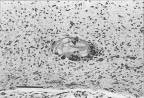 Section Of Jejunum From The Serosal Scarification Model Taken At