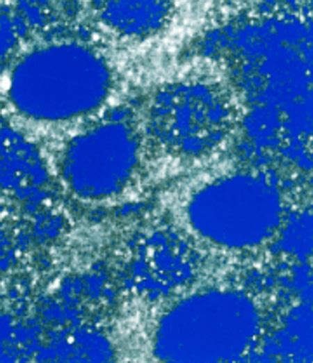 How Much Protein Structure Loss Is There Following Glutaraldehyde