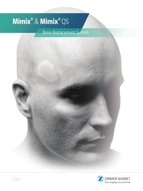 Catalogo Mimix Pdf Skull Surgery