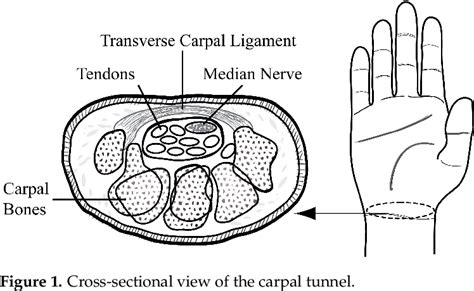 Figure 1 From Convolutional Neural Network Approaches In Median Nerve Morphological Assessment