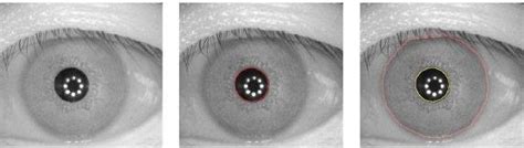 A Original Image B Pupil Boundary C Final Iris And Pupil Boundary Download Scientific