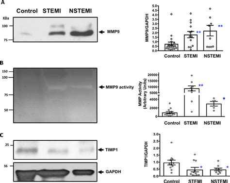 Platelet Biomarker Evaluation In Stemi And Nstemi All Patients Were