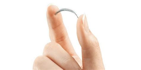 Permanent Birth Control Coil Pulled From Non Us Markets Clinical And